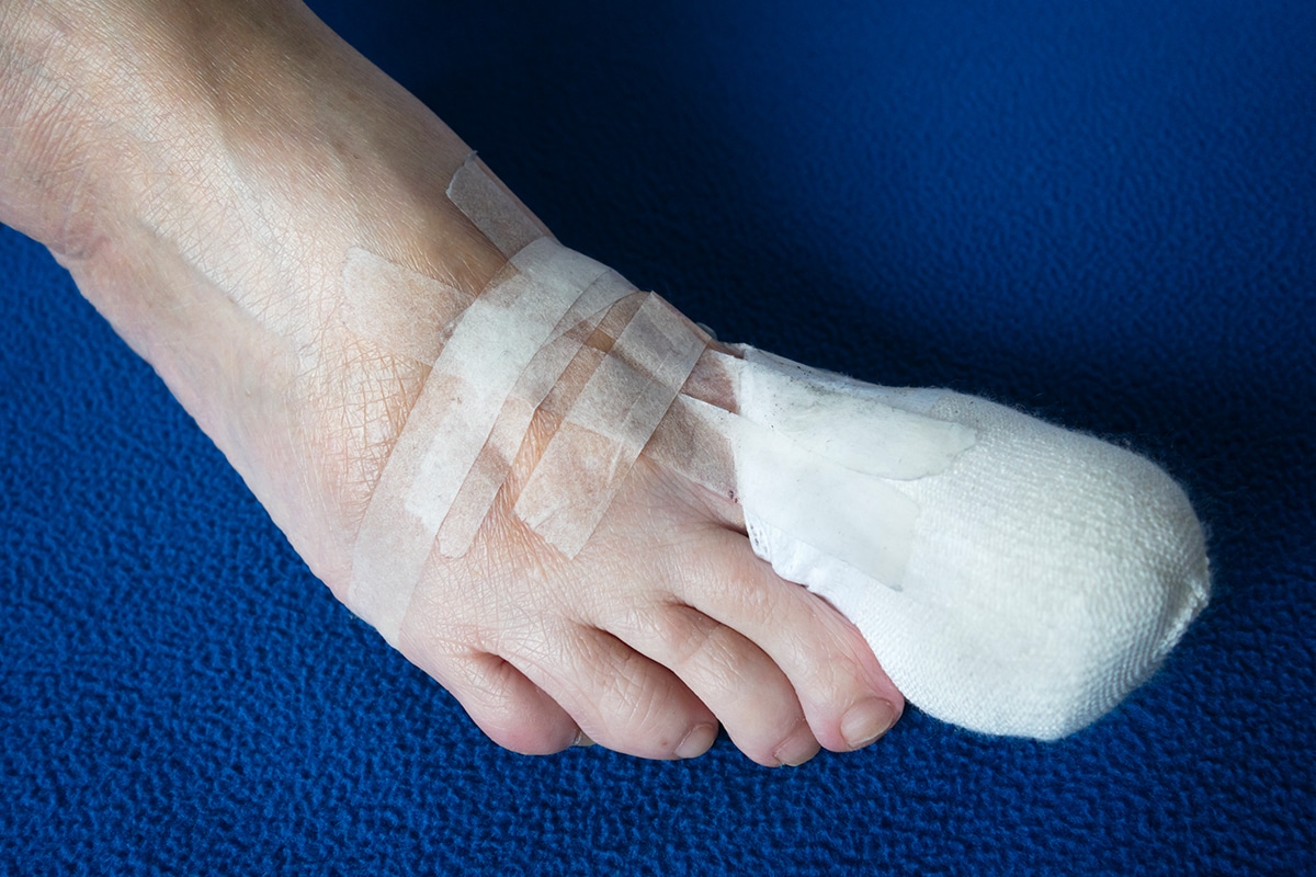 Surgical Services in Naperville, IL | Illinois Podiatry Specialists